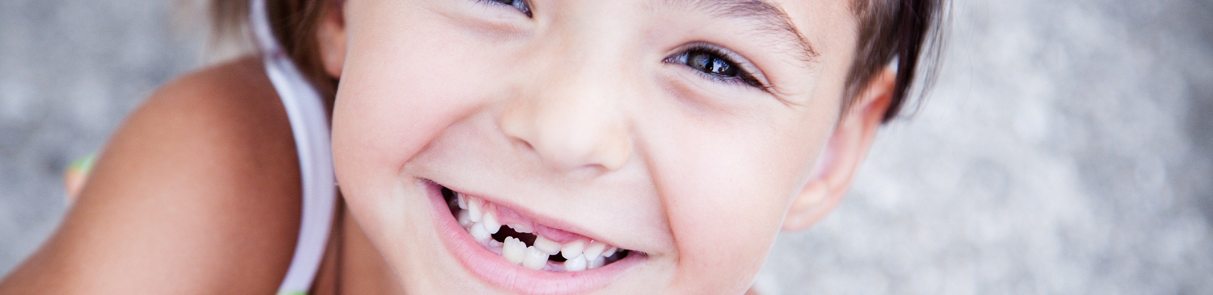 Space Maintainers - The Tooth Company Orthodontics